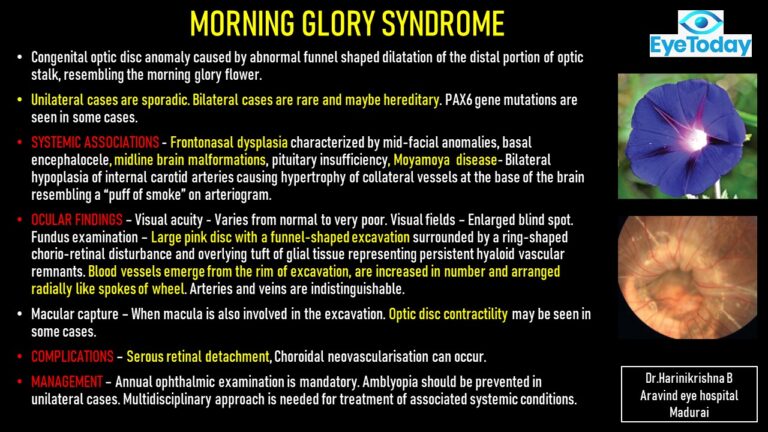 Morning Glory Syndrome Eyetoday